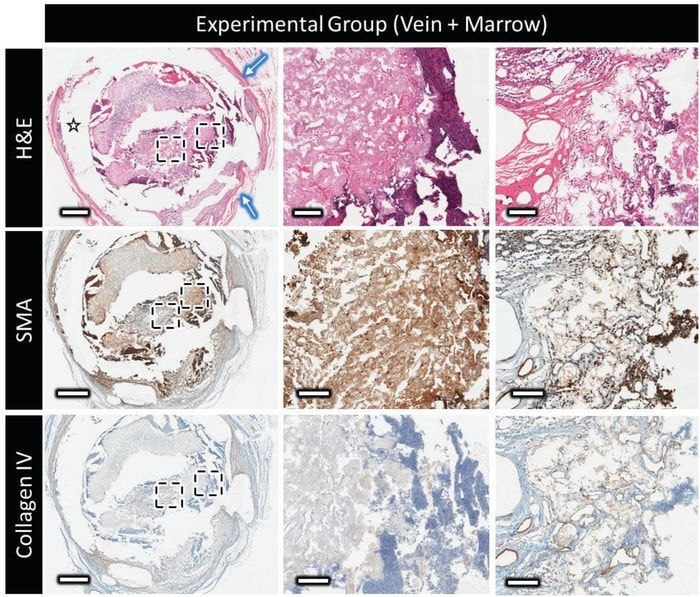 Alpha-Smooth Muscle Actin Antibody (14-9760-82)
