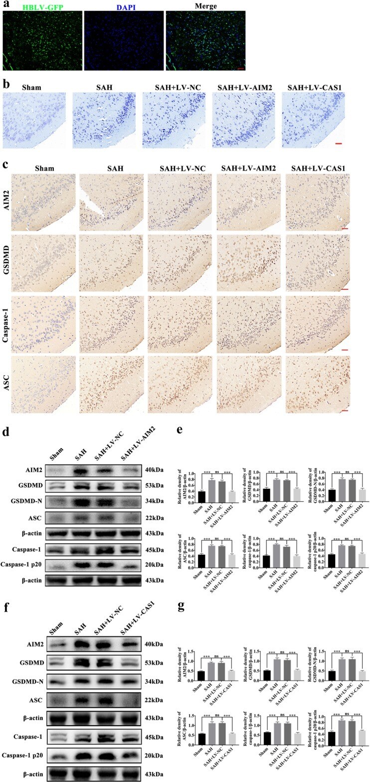 AIM2 Antibody (14-6008-93)