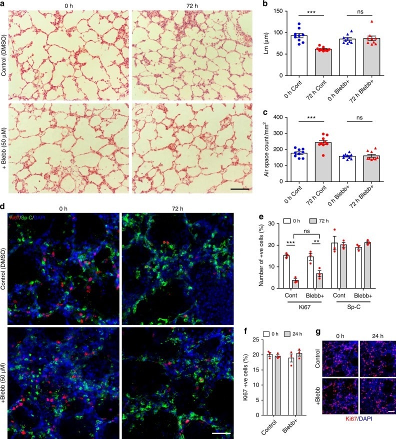 Ki-67 Antibody (14-5698-82)