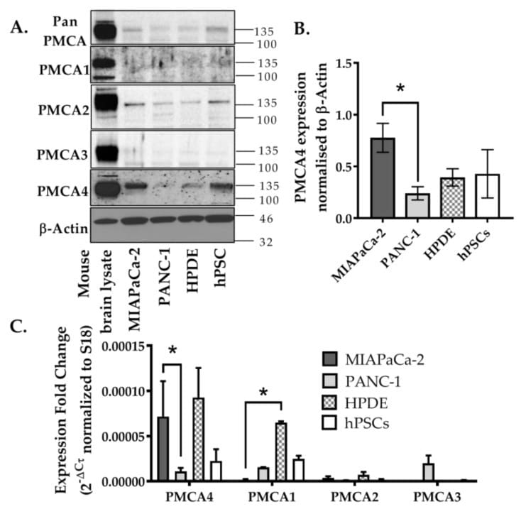 PMCA2 ATPase Antibody (PA1-915)
