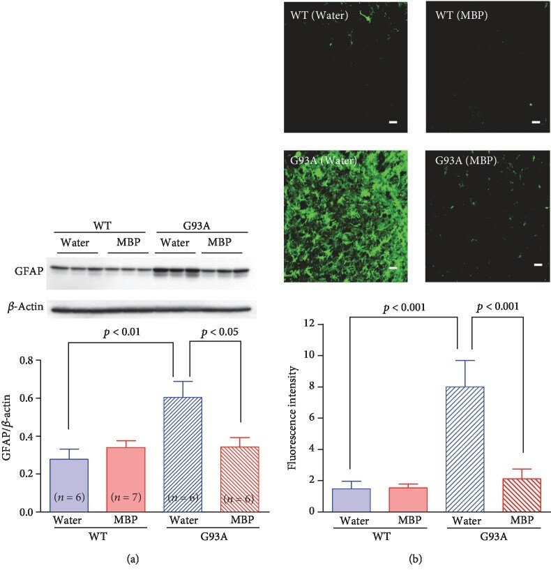 GFAP Antibody, Alexa Fluor™ 488 (53-9892-82)