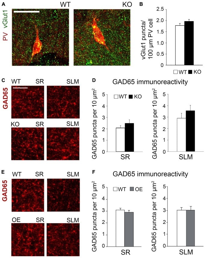 VGLUT1 Antibody (48-2400)