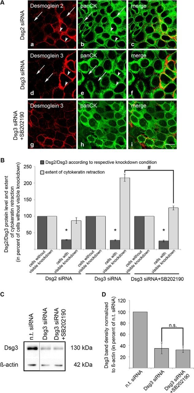 Desmoglein 3 Antibody (MA5-16025)