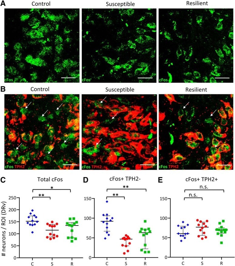 TPH2 Antibody (PA1-778)