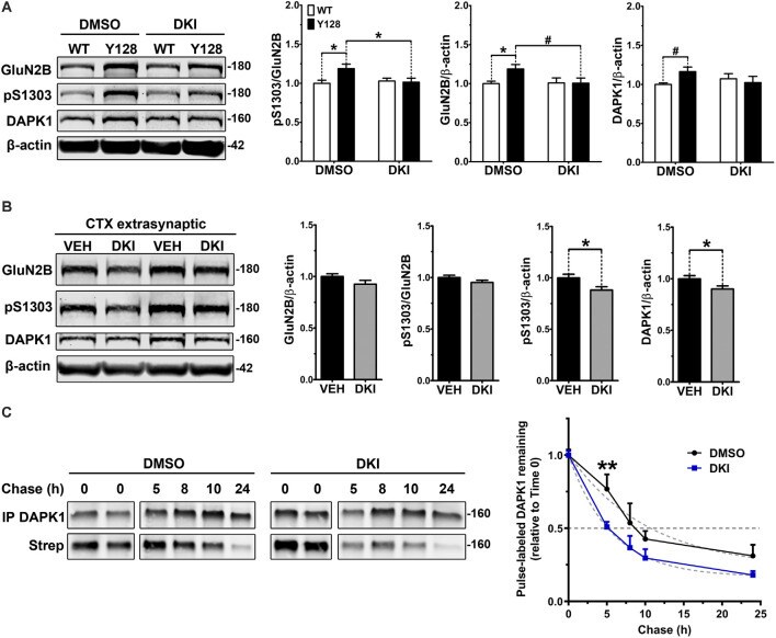 NMDAR2B Antibody (MA1-2014)